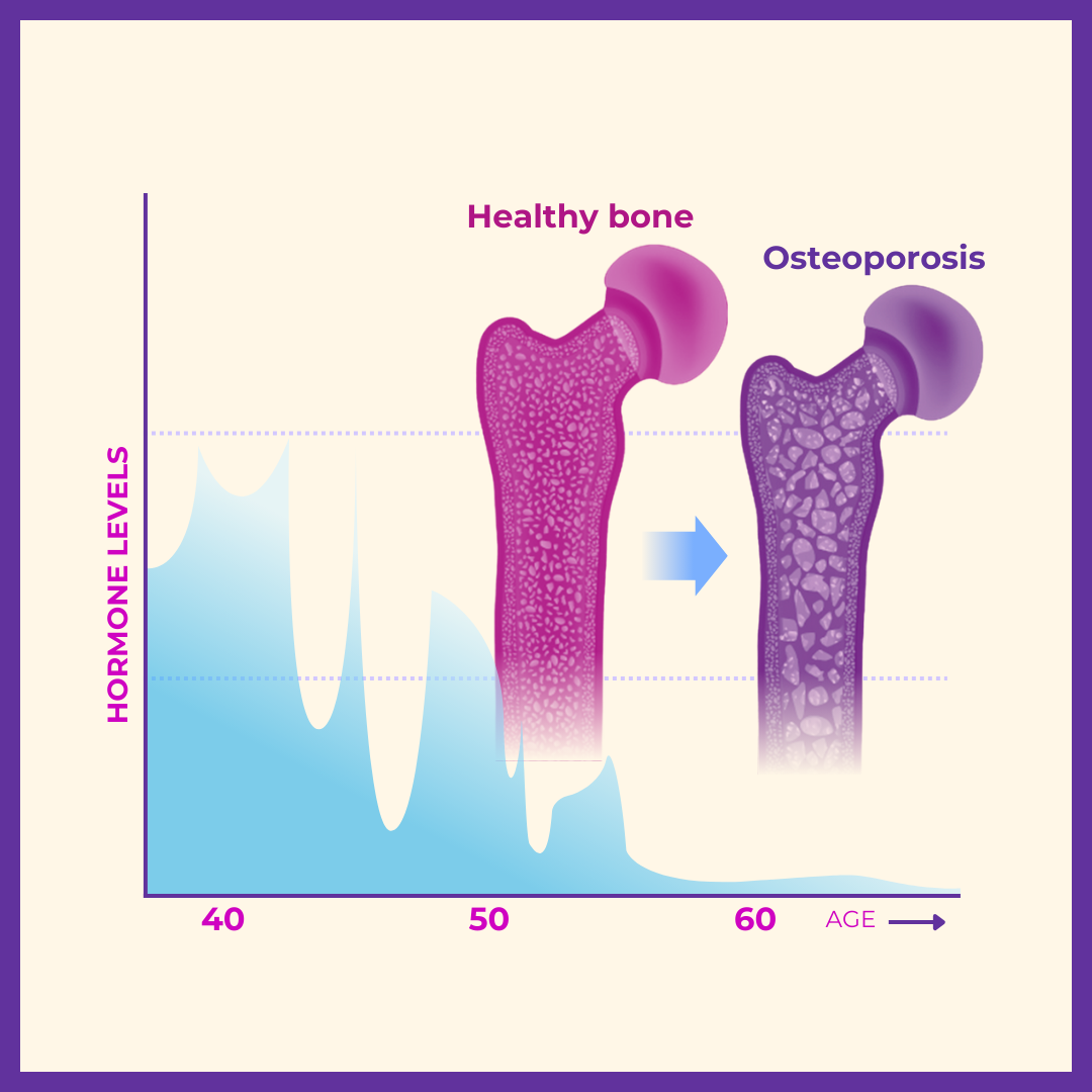 Parlor Games | Menopause Research